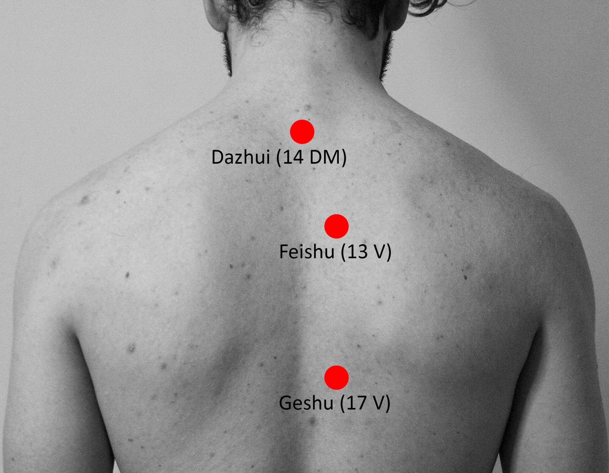 Feishu(13V)1 - Escuela Li Ping de Acupuntura y MTC